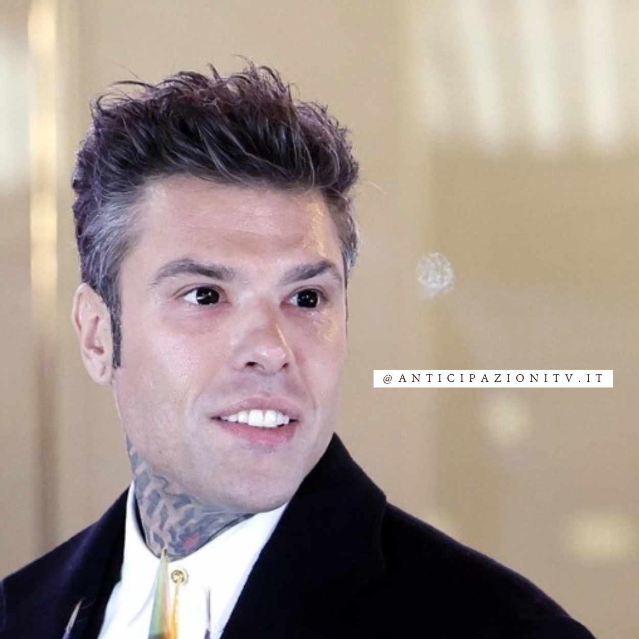Sanremo, Fedez con gli occhi neri sul red carpet: le ipotesi